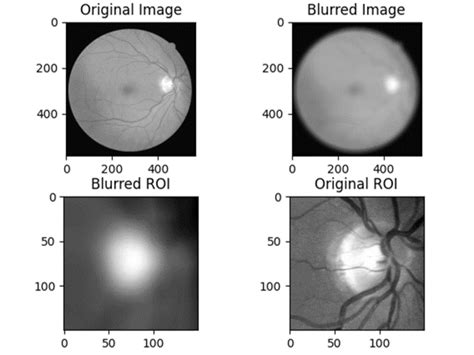 Image Processing Solutions Both In Python And Matlab Upwork