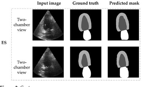 Figure 1 From Segmentation Of Anatomical Structures Of The Left Heart From Echocardiographic