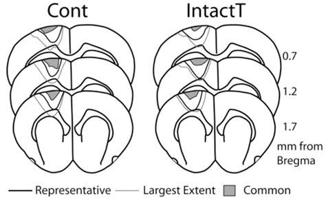Schematic Coronal Sections Throughout The Sensorimotor Cortex Showing Download Scientific