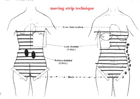 Ovary Flashcards Quizlet