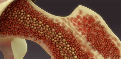 Hematology Hemato Oncology And Bone Marrow Transplantation
