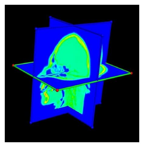 Interactive Volume Clipping A Ray Casting With Reslicing B Ray Download Scientific