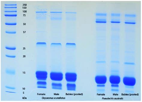 One Dimensional SDS PAGE Comparison Of Adult Female And Male Parents Download Scientific