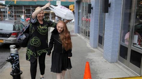 Photos Australian Model With Downs Syndrome Makes Strides Worldwide Hindustan Times