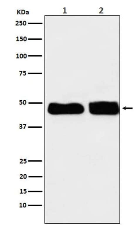 C4 Binding Protein B Antibody Sr1762 Novus Biologicals 50 μg Unconjugated Antibodies