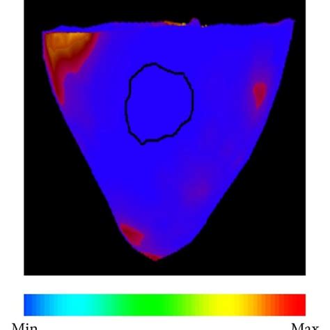 source estimation using l p norm regularization for 1 ≤ p ≤ 2 a 58