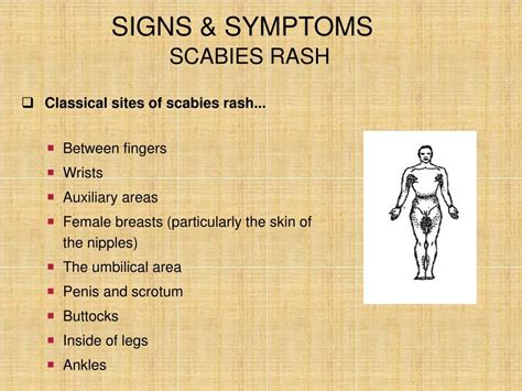 Ppt Scabies Life Cycle Diagnosis And Treatment Powerpoint Presentation