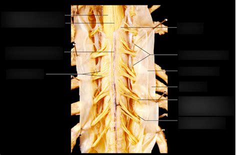 Cervical Region Of Spinal Cord Ventral View Diagram Quizlet
