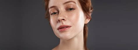 Treating Hyperpigmentation And Melasma With Obagi Nuderm System