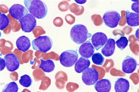 Cd Markers Review Lecture 19 Flashcards Quizlet