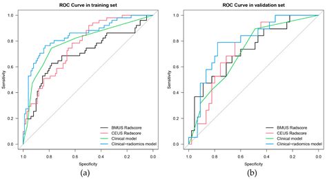 Predicting Extrathyroidal Extension In Papillary Thyroid Carcinoma Using A Clinical Radiomics