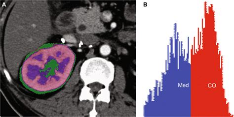 Automated Segmentation Process Using A Histogram Split Algorithm Ostu Download Scientific
