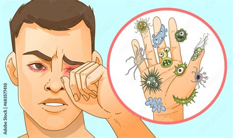 Eye Irritation Causing Runny Nose At Alicia Christenson Blog