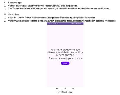Eye Diseases Detection Using Ml