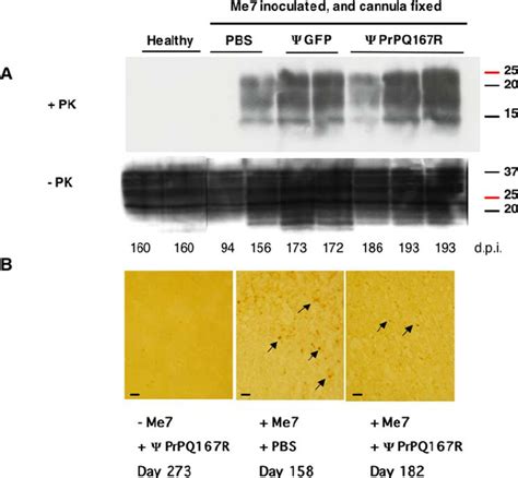 Analysis Of Prp Sc Accumulation In The Brains Of Mice After Treatment Download Scientific