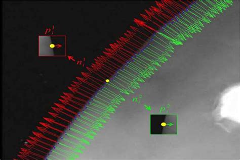 Figure 7 From The Image Segmentation And Polyp Detection In Colonoscopy
