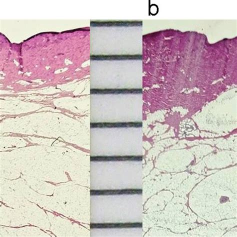 Histological Sections Hande Of Porcine Skin Specimens From The Belly