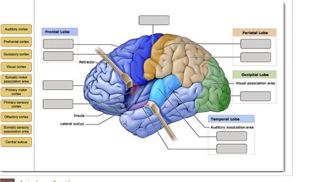 Solved Auditory Cortex Frontal Lobe Parietal Lobe Prefrontal Cortex