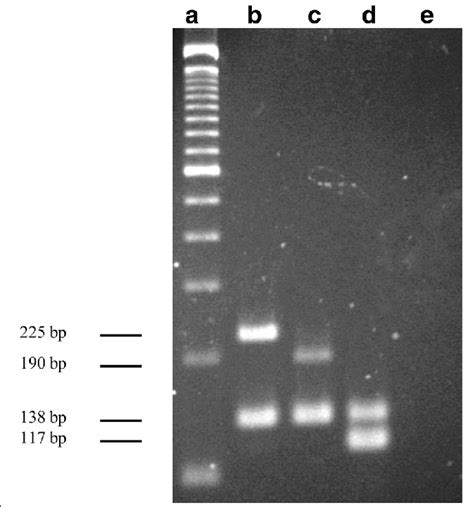 Multiplex Pcr Assay For Simultaneous Detection Of Cfb And Erythromycin Download Scientific
