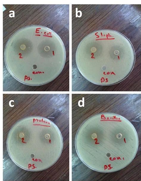 Antibacterial Activity Of Bioemulsifier Produced By P Aeruginosa Download Scientific Diagram
