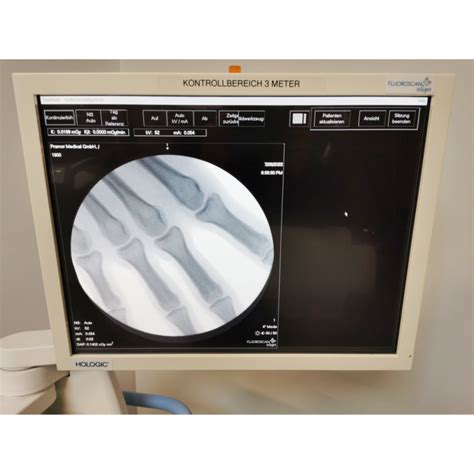 Mini C Arm Hologic Fluroscan Insight 2