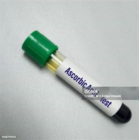 비타민 C 혈액 검사를위한 혈액 샘플은 비타민 C 결핍을 진단합니다 Coq10에 대한 스톡 사진 및 기타 이미지 Coq10 건강 진단 건강관리와 의술 Istock