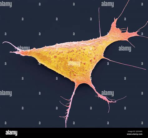 Human Induced Pluripotent Cell Coloured Scanning Electron Micrograph