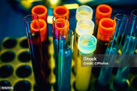 체 외 수정 과정 계란 검색 절차 실험실 계란의 수정에에서 사용 된 첨단 실험 장비 개념에 대한 스톡 사진 및 기타 이미지 개념 개념과 주제 건강관리와 의술 Istock