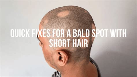 Quick Fixes For A Bald Spot With Short Hair Bald Lifestyle