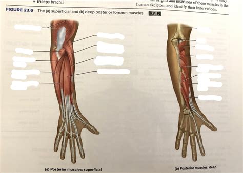 Arm Diagram Quizlet