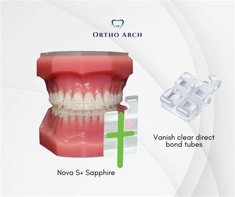 Ortho Arch Company On Linkedin The Nova S Sapphire And Vanish Clear
