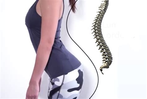 تمرینات مناسب برای گودی کمر