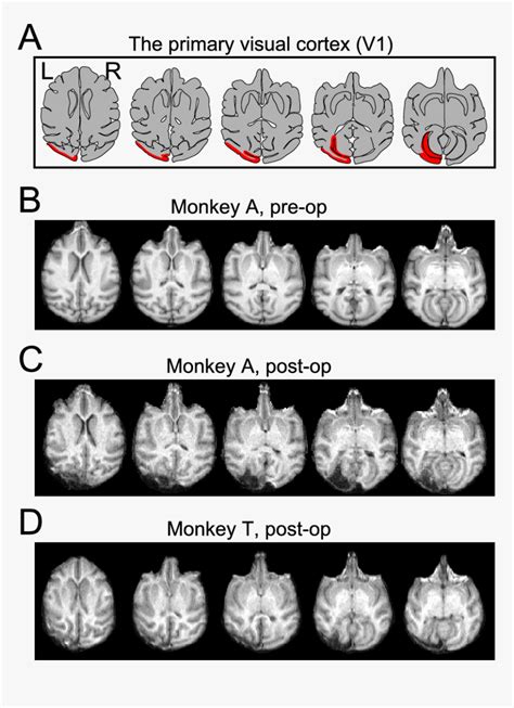 Visual Cortex Primate Horizontal Section Hd Png Download Kindpng