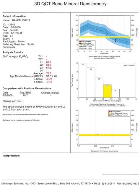 Mindways Qct Pro Bone Density Report Samples