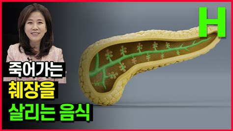 췌장암 예방하는 해독 음식 매일 드시면 췌장 염증 얼씬도 못해요 Youtube