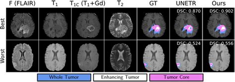 Modality Agnostic Learning For Medical Image Segmentation Using Multi Modality Self Distillation