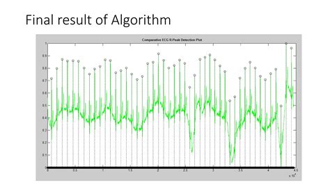 iot based ecg monitoring system using node mcu ppt