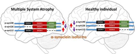 Altered α‐synuclein Parkin And Synphilin Isoform Levels In Multiple System Atrophy Brains