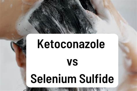 Selenium Sulfide Vs Ketoconazole Which Is Better