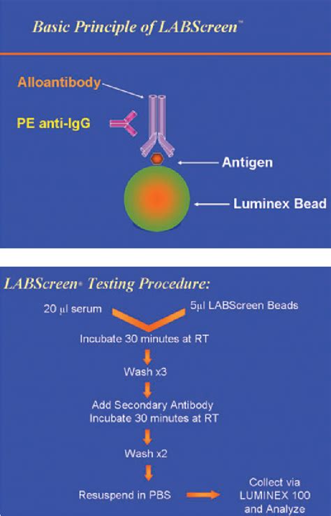 Figure 1 From Solid Phase HLA Antibody Detection Technology Challenges In Interpretation