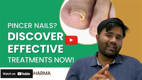Pincer Fingernails Symptoms Causes And Treatment Options