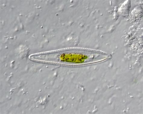 273 Best Diatoms Images On Pholder Microscopy Micro Porn And Planted
