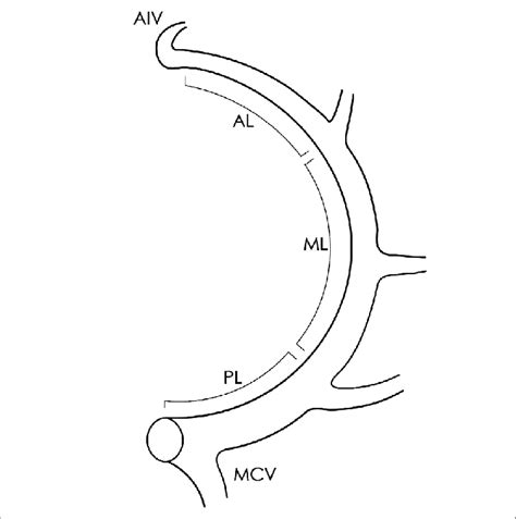 Depiction Of The Coronary Sinus And Its Tributaries MCV Middle Download Scientific Diagram