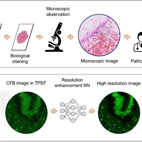 Workflow Of Biopsy Diagnosis And End To End Diagnosis A A Biopsy Is Download Scientific