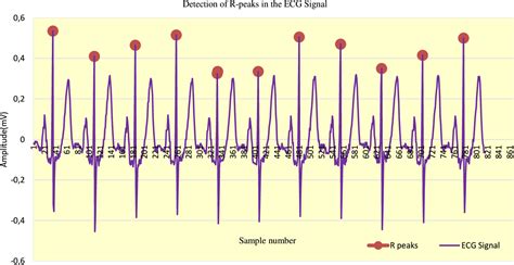 Figure 2 From Detection Of Obstructive Sleep Apnea From Ecg Signal Using Svm Based Grid Search