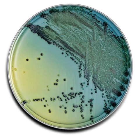 Bd Bbl™ Prepared Plated Media Clostridium Difficile Selective Agar Clostridium Difficile