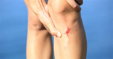 검게 물든 흉터 외상성 문신어떻게 제거할까