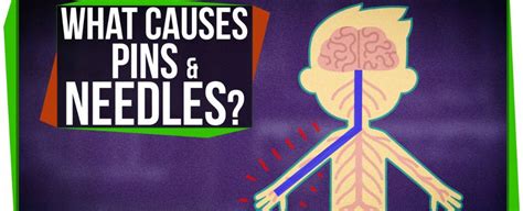 Watch What Causes Pins And Needles Sciencealert