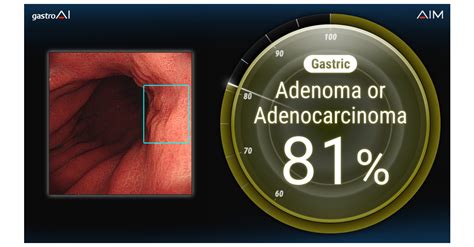 Ai Medical Service Inc Completes First Regulatory Review And Device Registration Of Gastric Ai