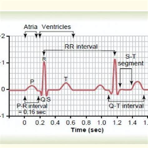Pat Defined As Time Interval Between R Peak Of Ecg And 10 T 10 Or